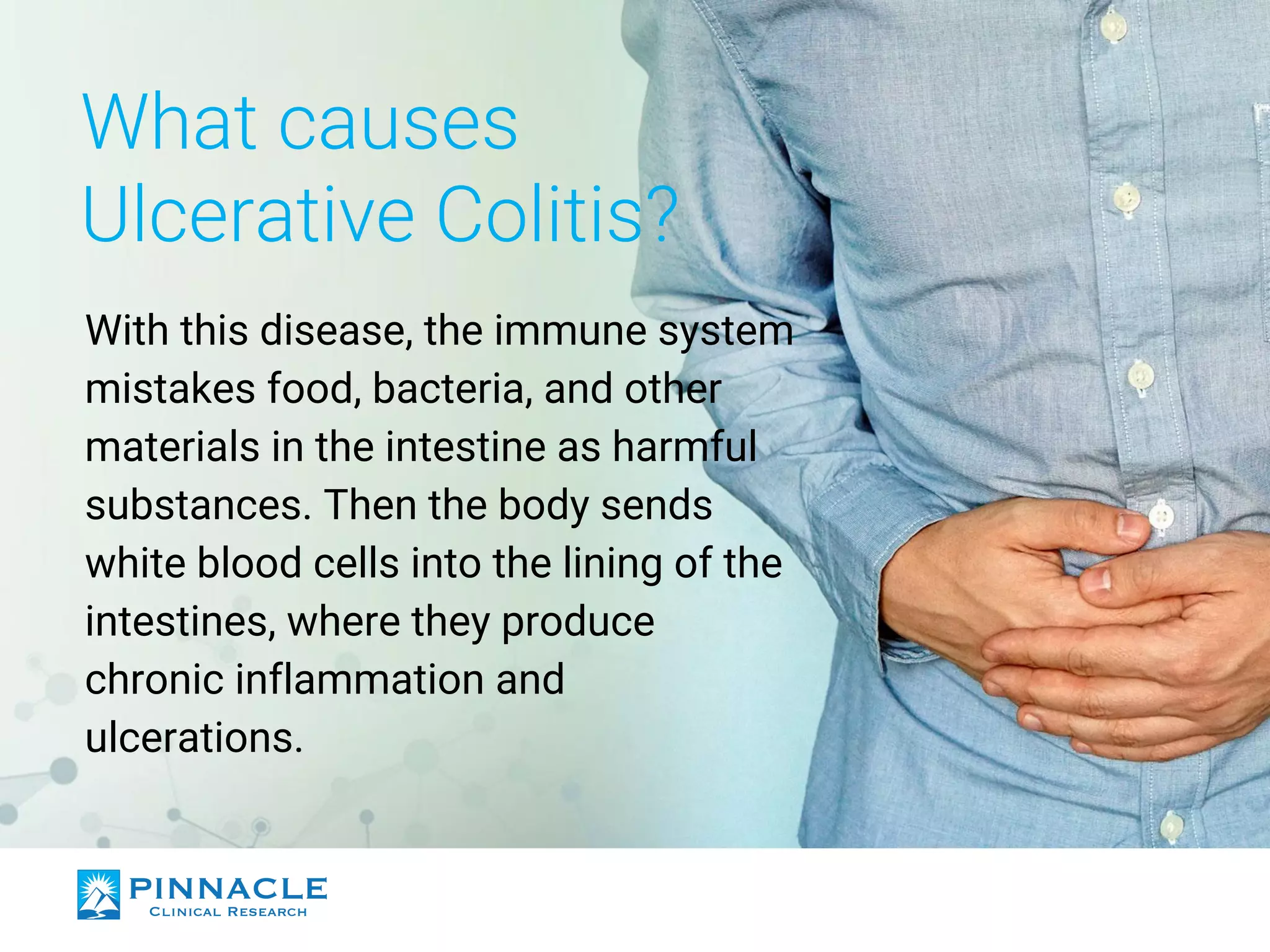Understanding Ulcerative Colitis | PDF