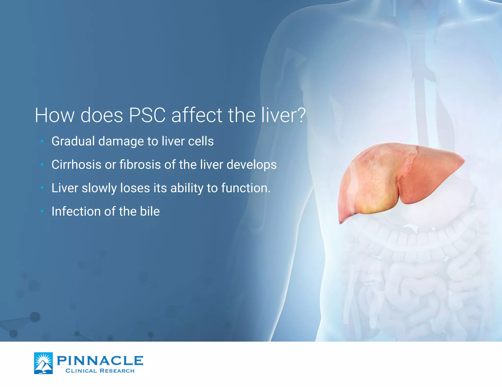 Primary Sclerosing Cholangitis (PSC) | PDF