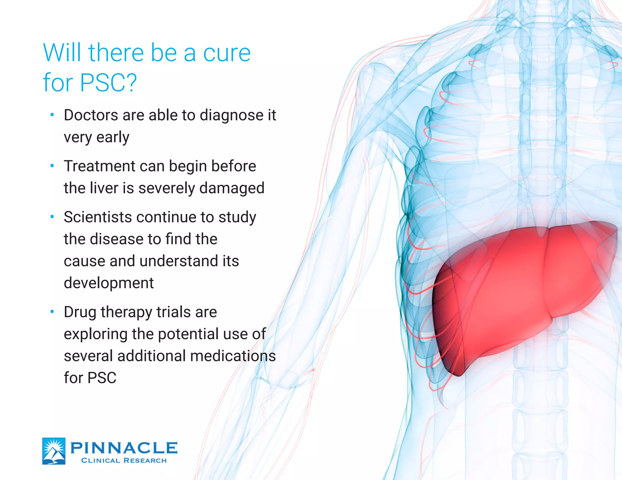 Primary Sclerosing Cholangitis (PSC) | PDF