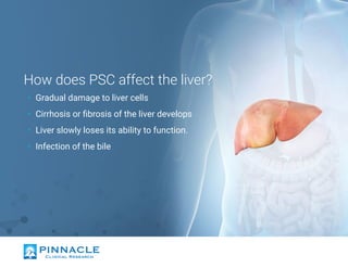 Primary Sclerosing Cholangitis (PSC) | PDF