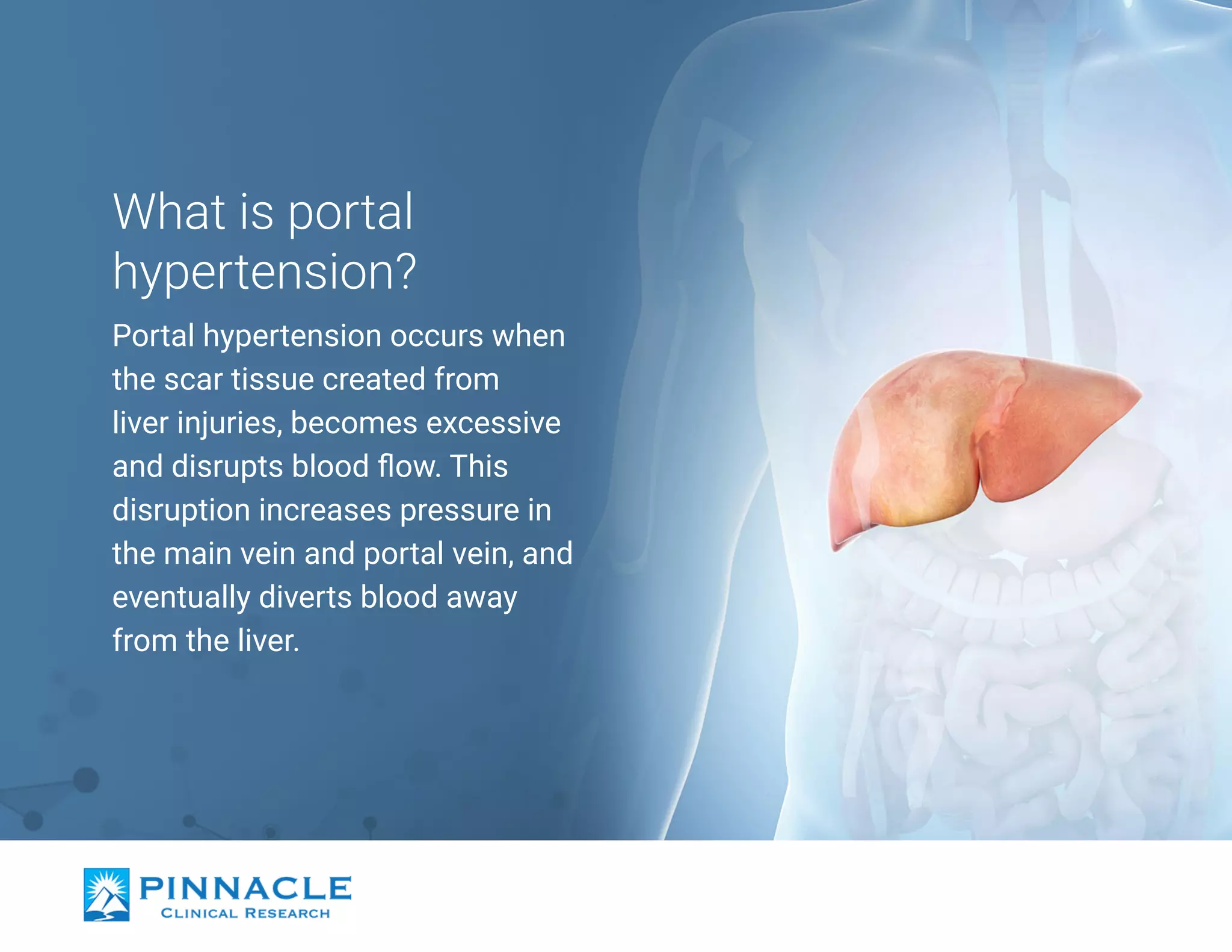 Portal Hypertension | PDF
