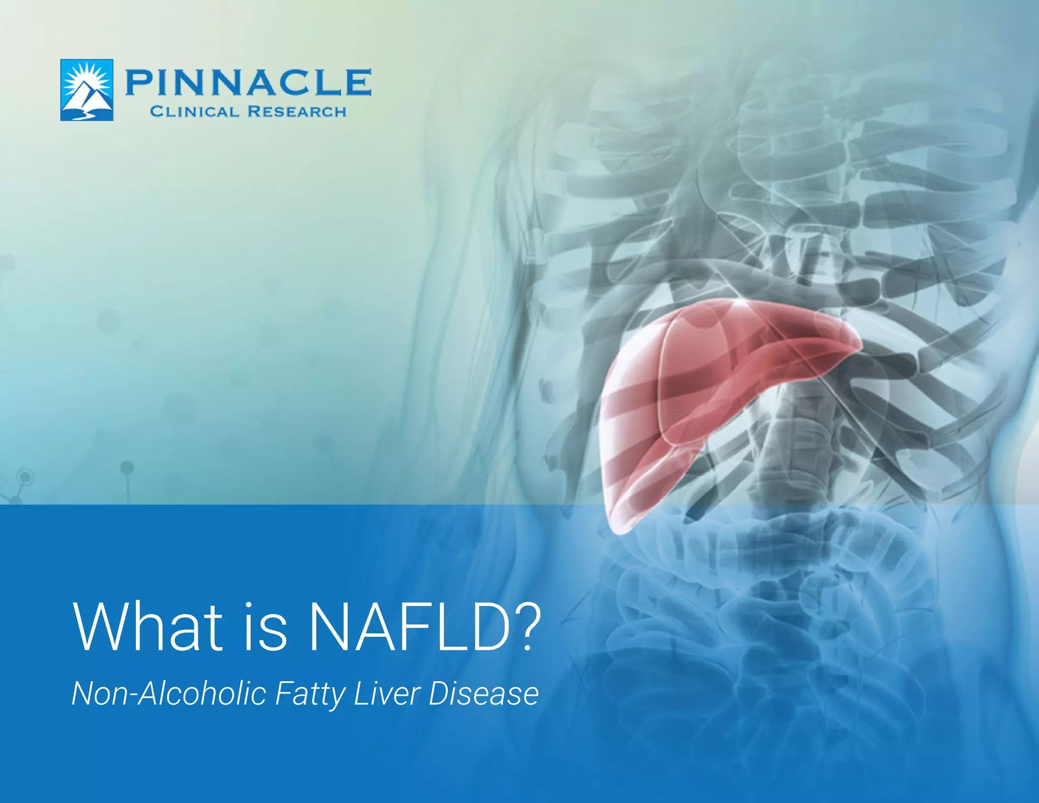 What is Non Alcoholic Fatty Liver Disease? | PDF
