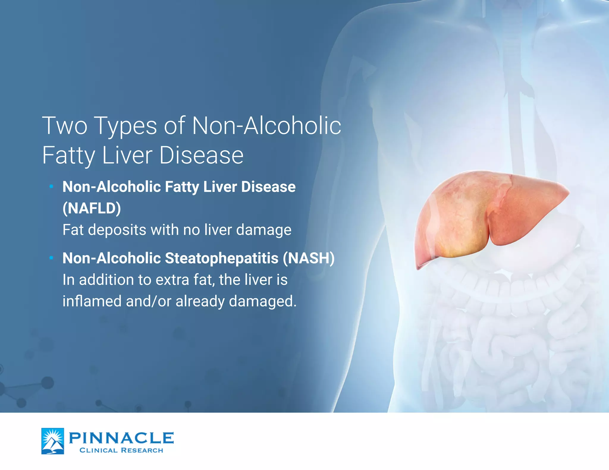What is Non Alcoholic Fatty Liver Disease? | PDF