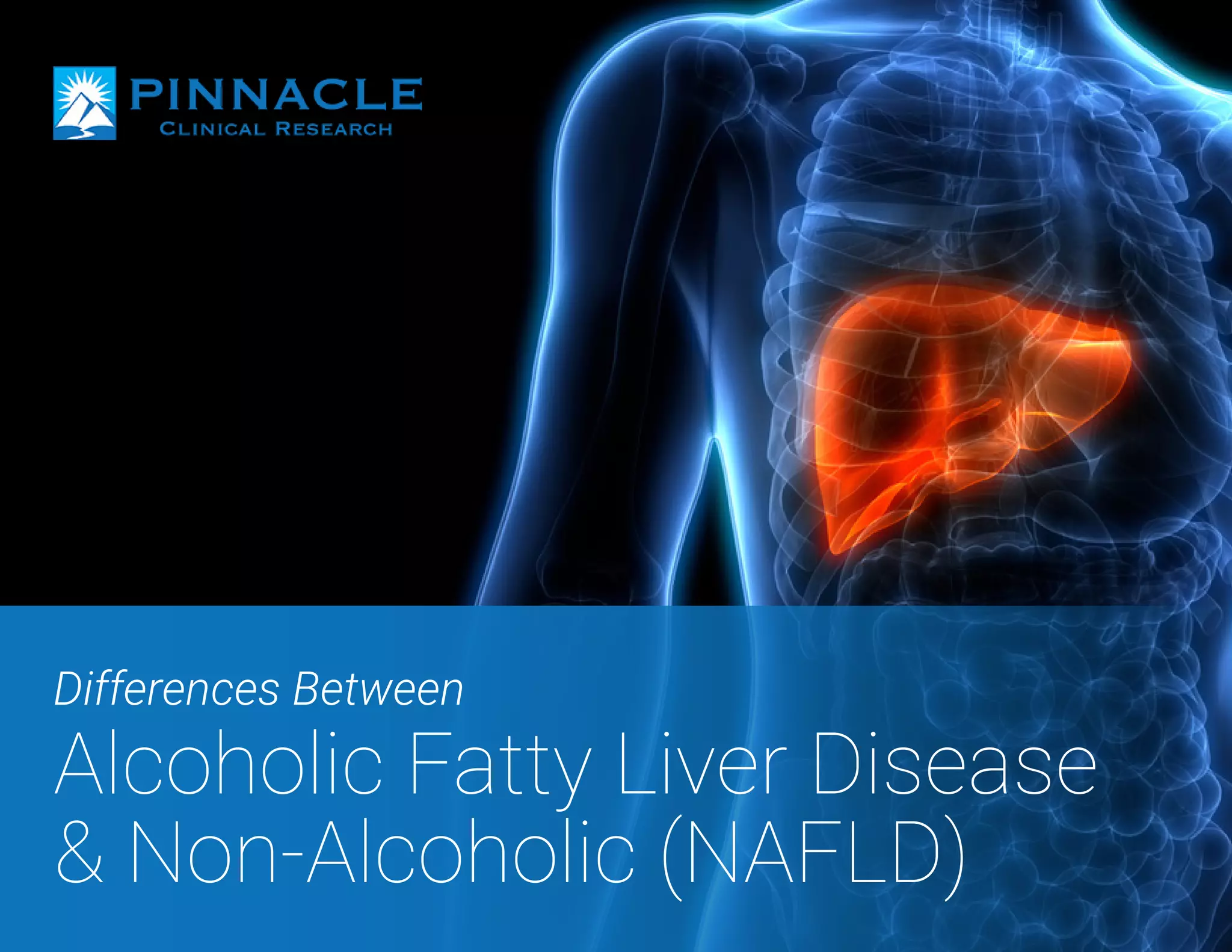 Differences between alcoholic fatty liver disease and non alcoholic ...