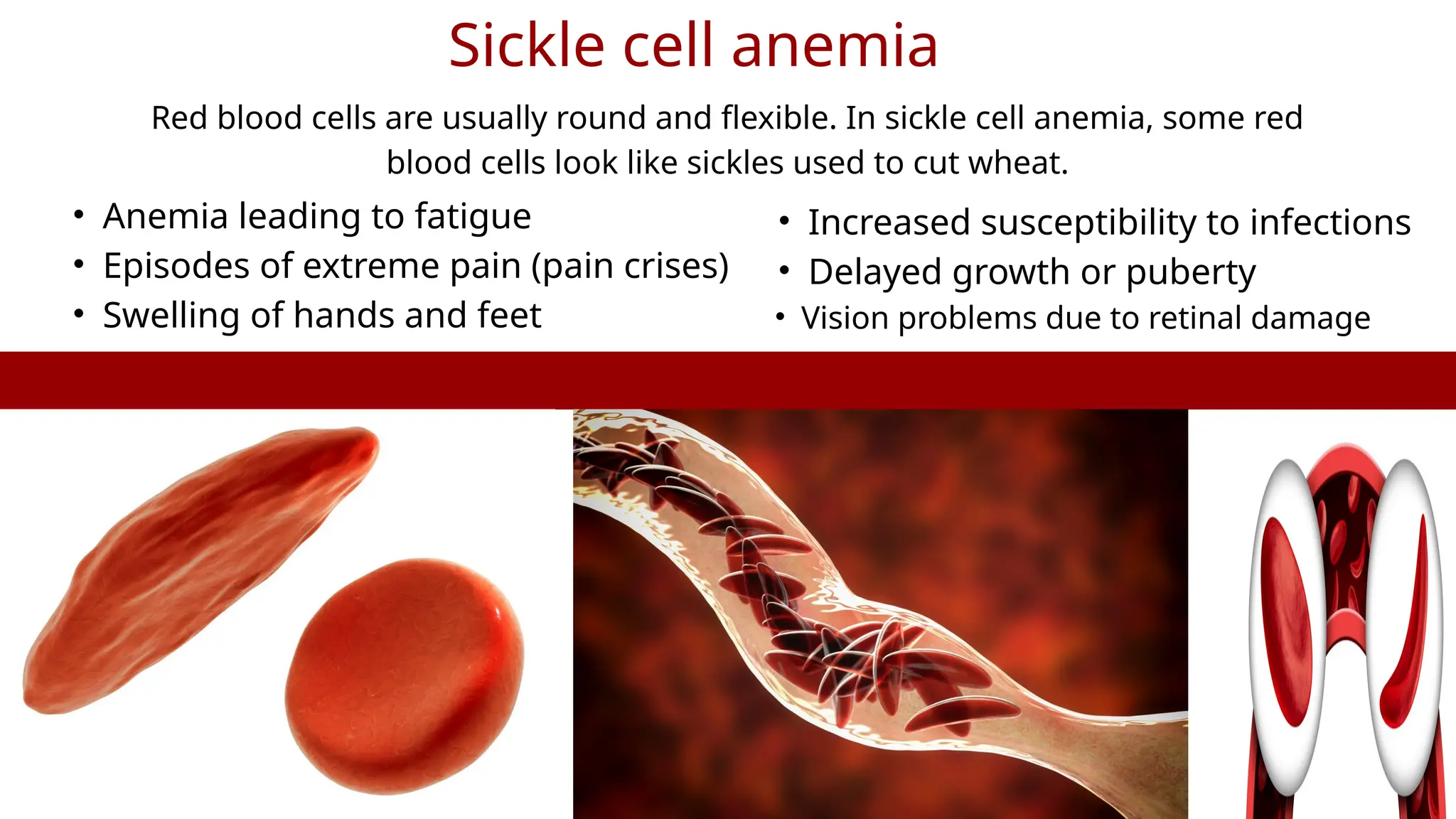 anemia and its disorders and all about blood disese | PPT