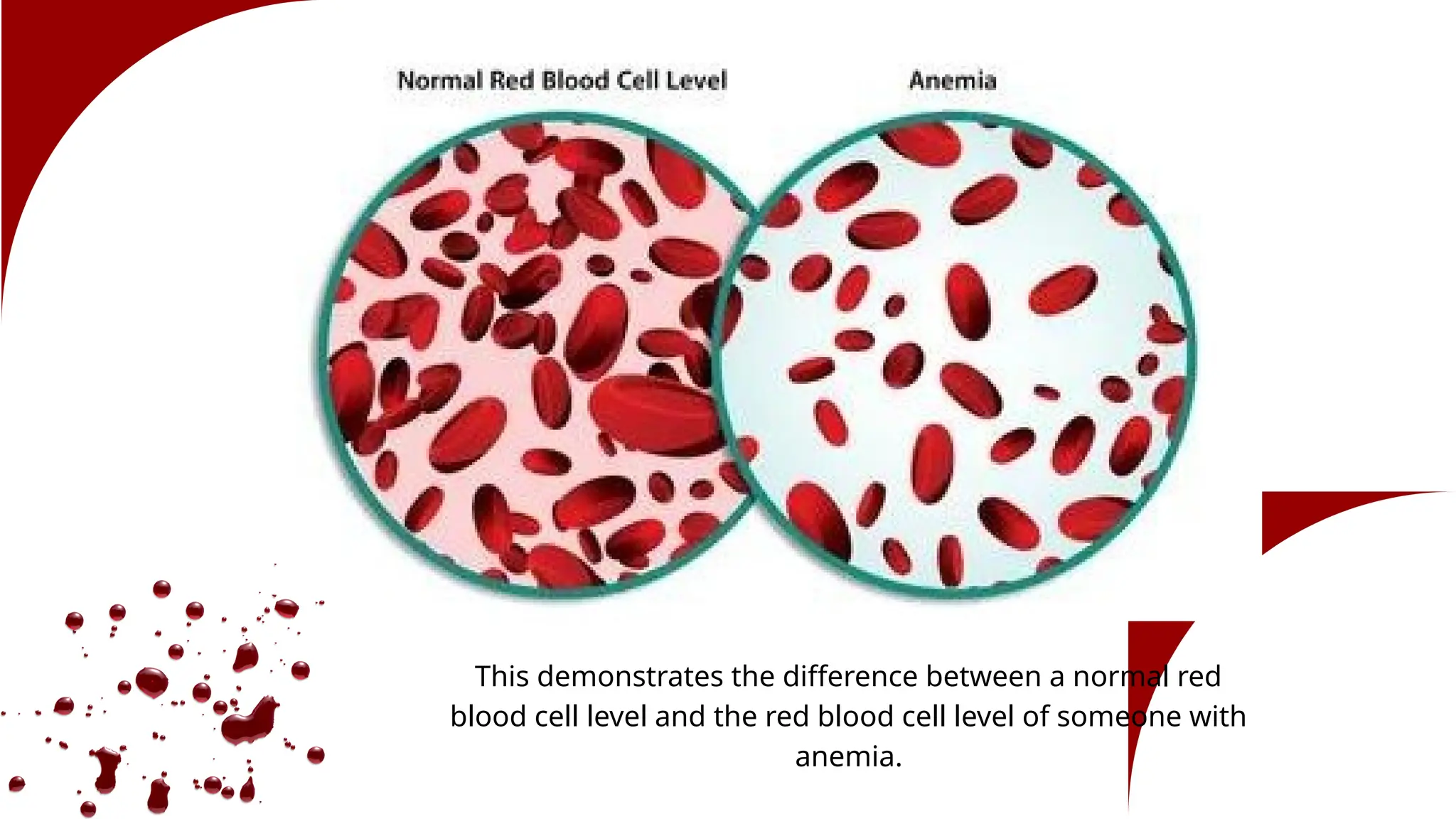 anemia and its disorders and all about blood disese | PPT
