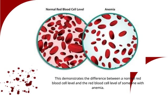anemia and its disorders and all about blood disese | PPT