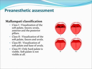Pre-anaesthetic evaluation.ppt
