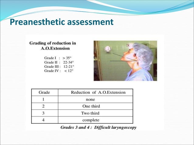 Pre-anaesthetic evaluation.ppt | Surgery | Medical Health