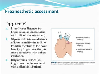 Pre-anaesthetic evaluation.ppt