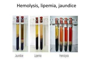 pre-analytical phase (1).pptx