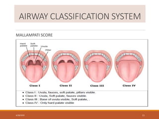 Pre anesthetic by dr.nikhil | PPT