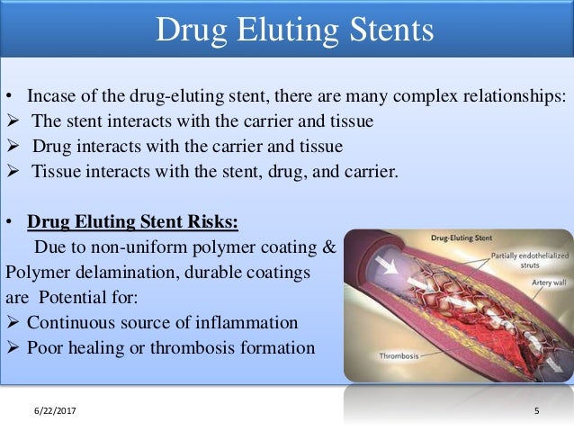 Drug Eluting Stent Mri Safety _ Xience Stent Test – ATCYE