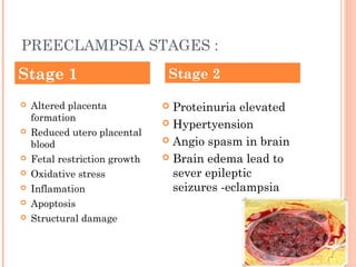 Pre eclampsia complication /jordan uni of science and technology | PPT