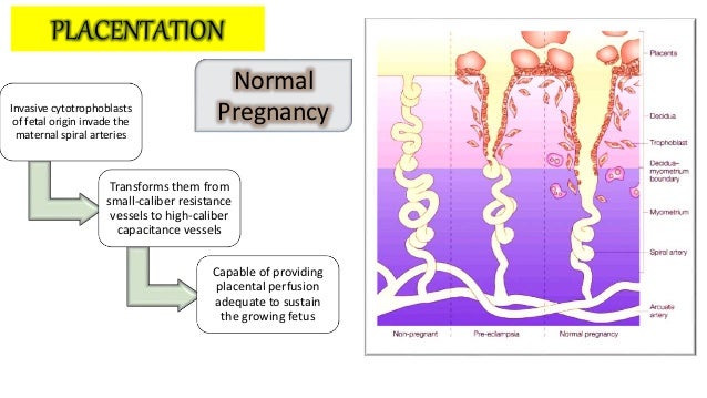 pathogenesis of Pre eclampsia