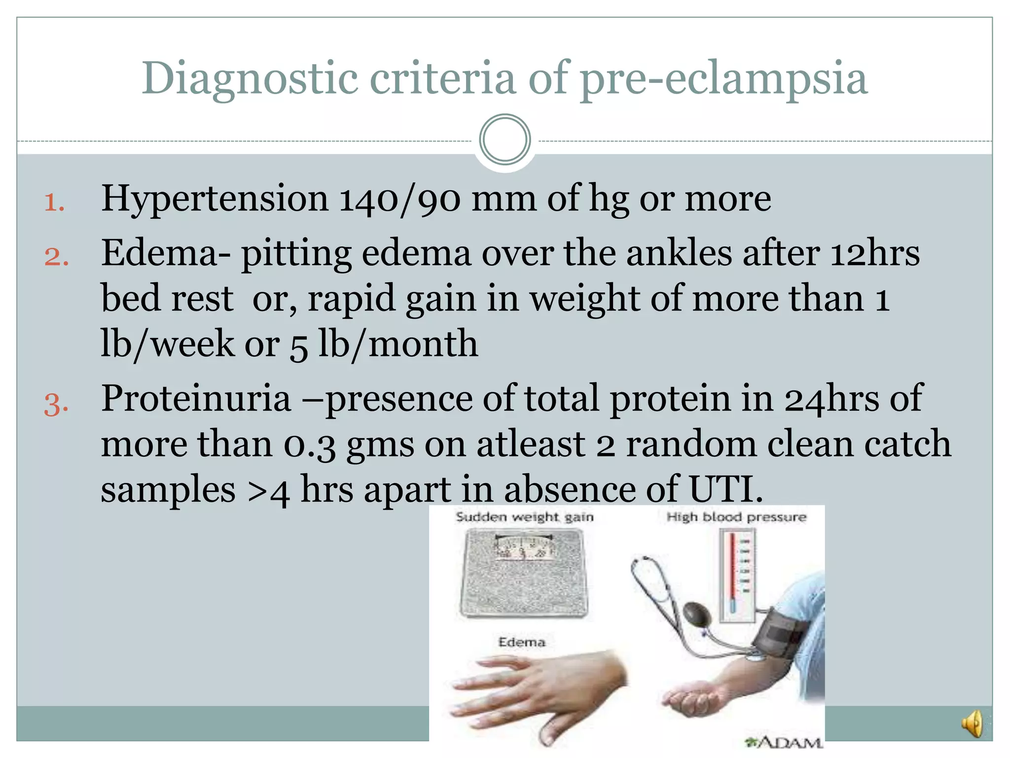 Pre eclampsia | PPTX