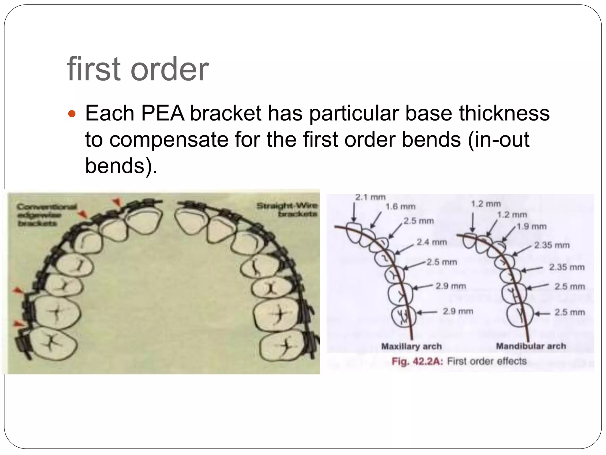 pre-adjusted edgewise appliance (PEA) | PPTX
