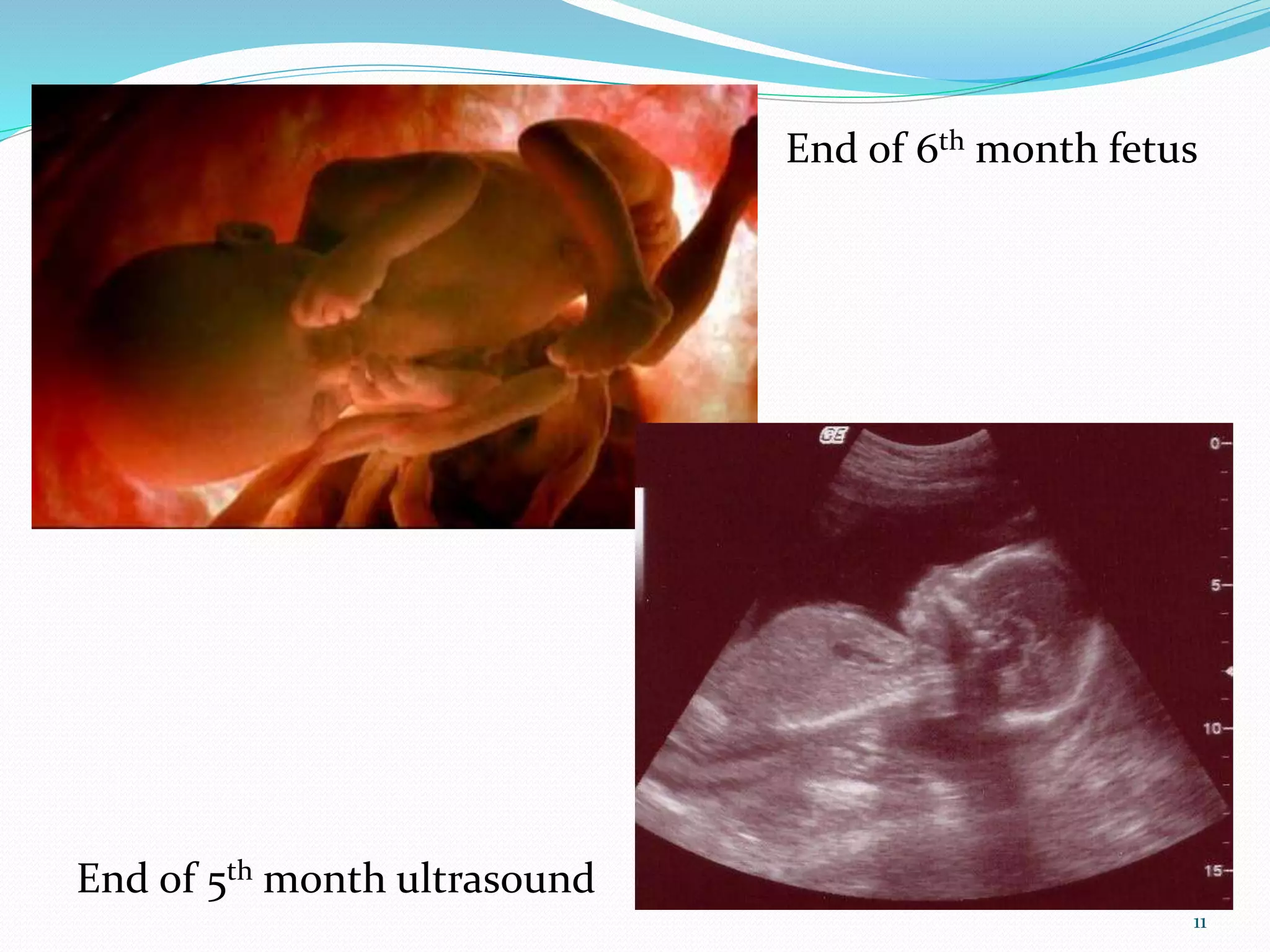 Pre embryonic development | PPTX