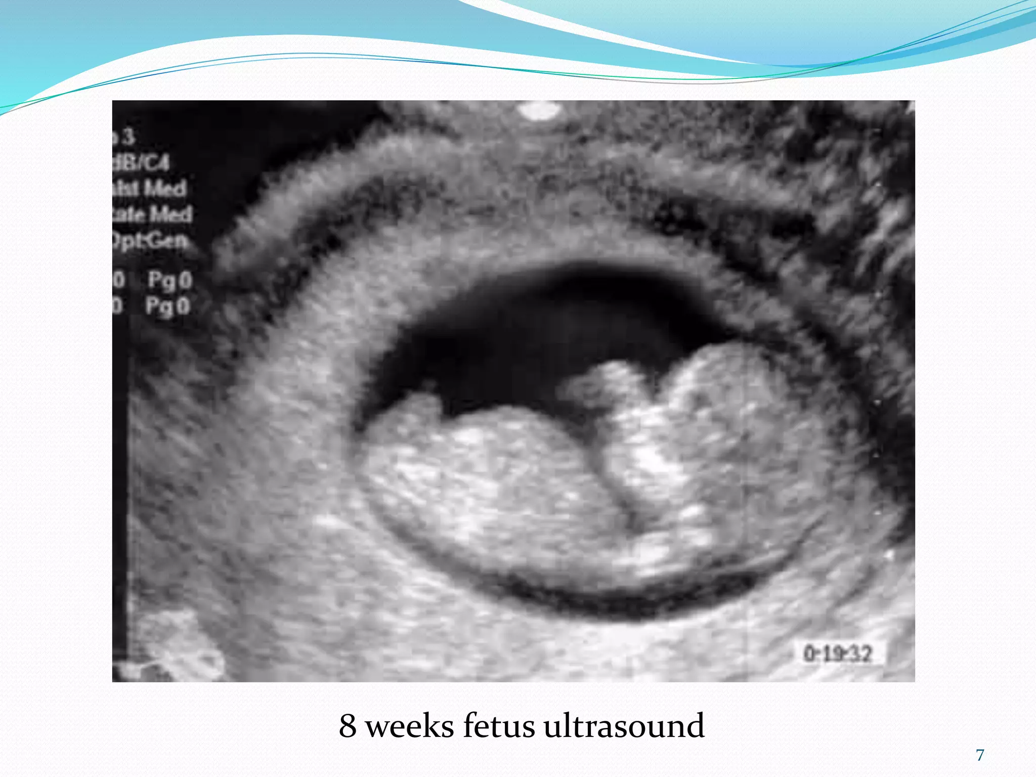 Pre embryonic development | PPTX