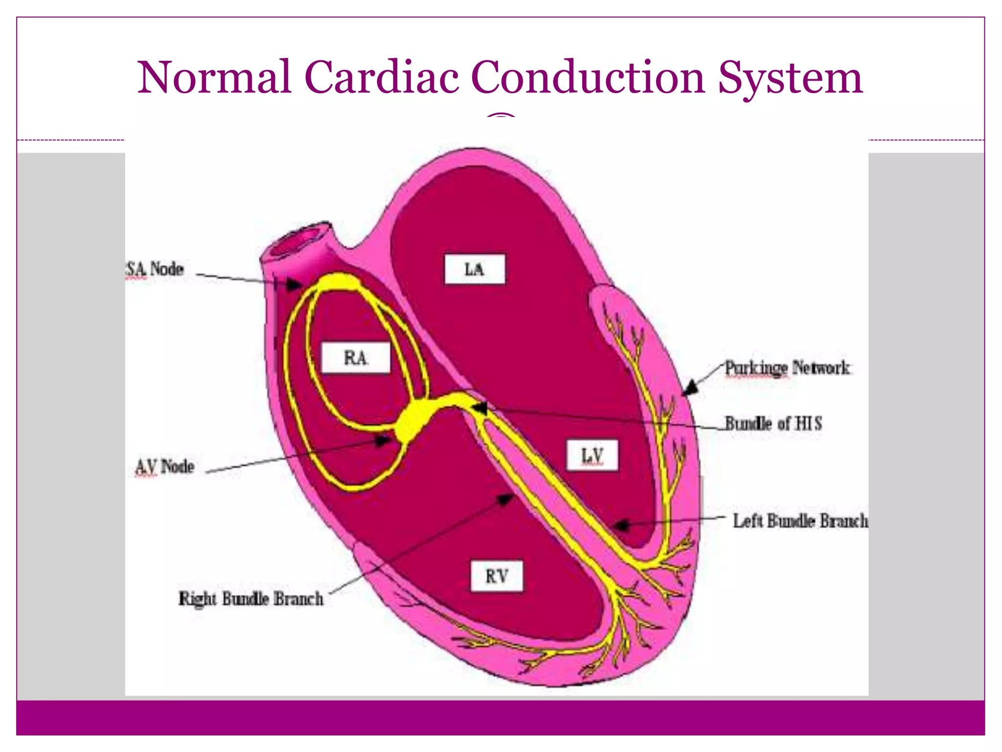 Basic of Pre-excitation syndrome | PPTX