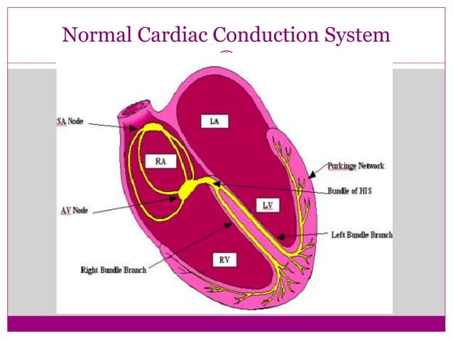 Basic of Pre-excitation syndrome | PPTX