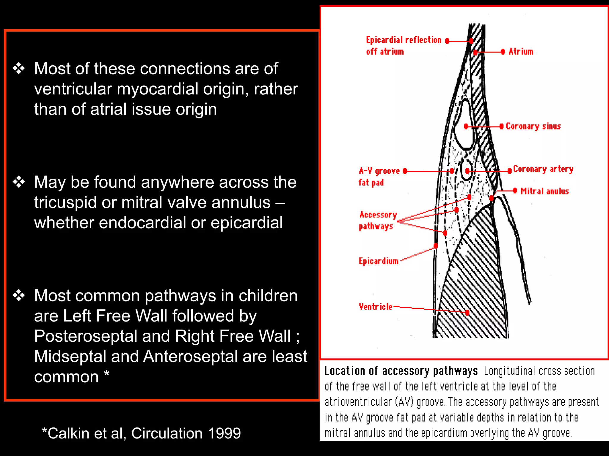 Pre-excitation Syndromes.ppt