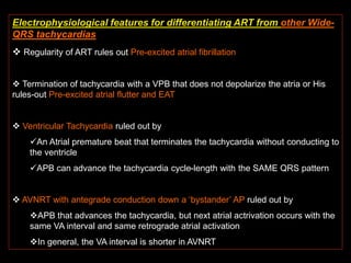 Pre-excitation Syndromes.ppt