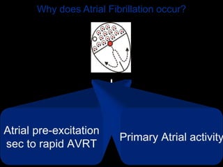 Pre-excitation Syndromes.ppt