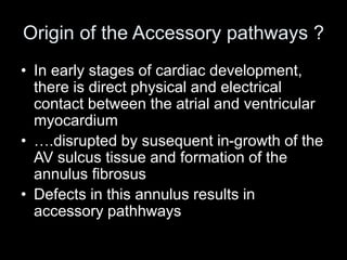 Pre-excitation Syndromes.ppt