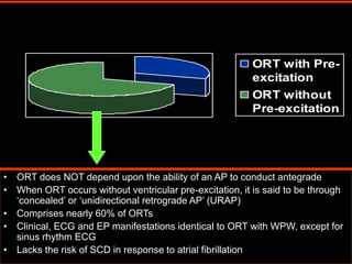 Pre-excitation Syndromes.ppt