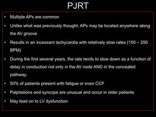 Pre-excitation Syndromes.ppt