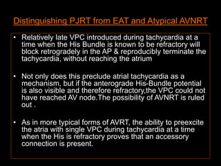 Pre-excitation Syndromes.ppt