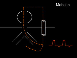 Pre-excitation Syndromes.ppt