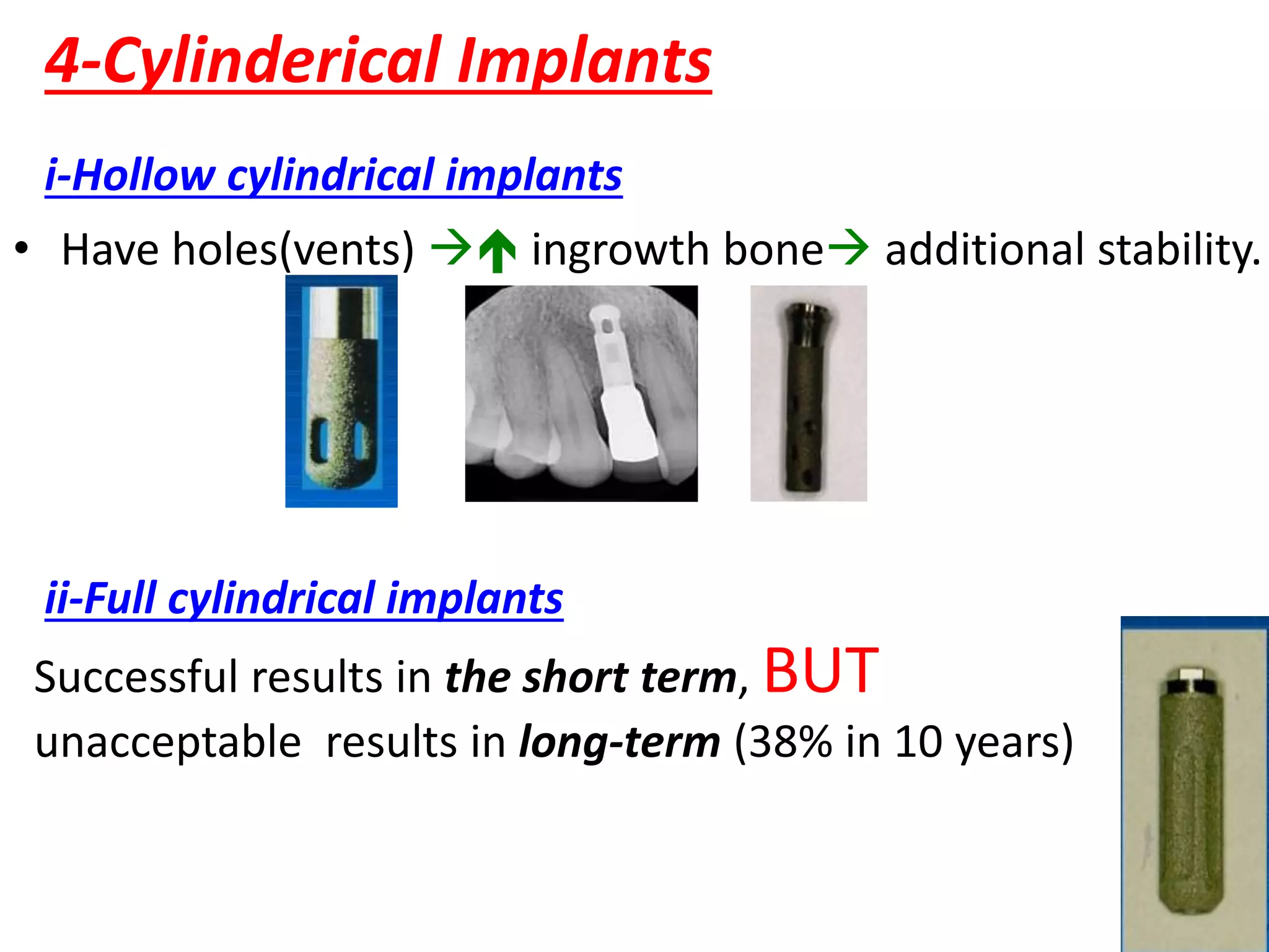 Pre implant anatomy, biology, function and risk factors of an implant ...