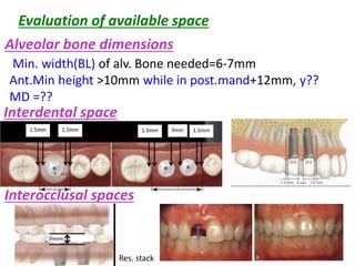 Pre implant anatomy, biology, function and risk factors of an implant ...