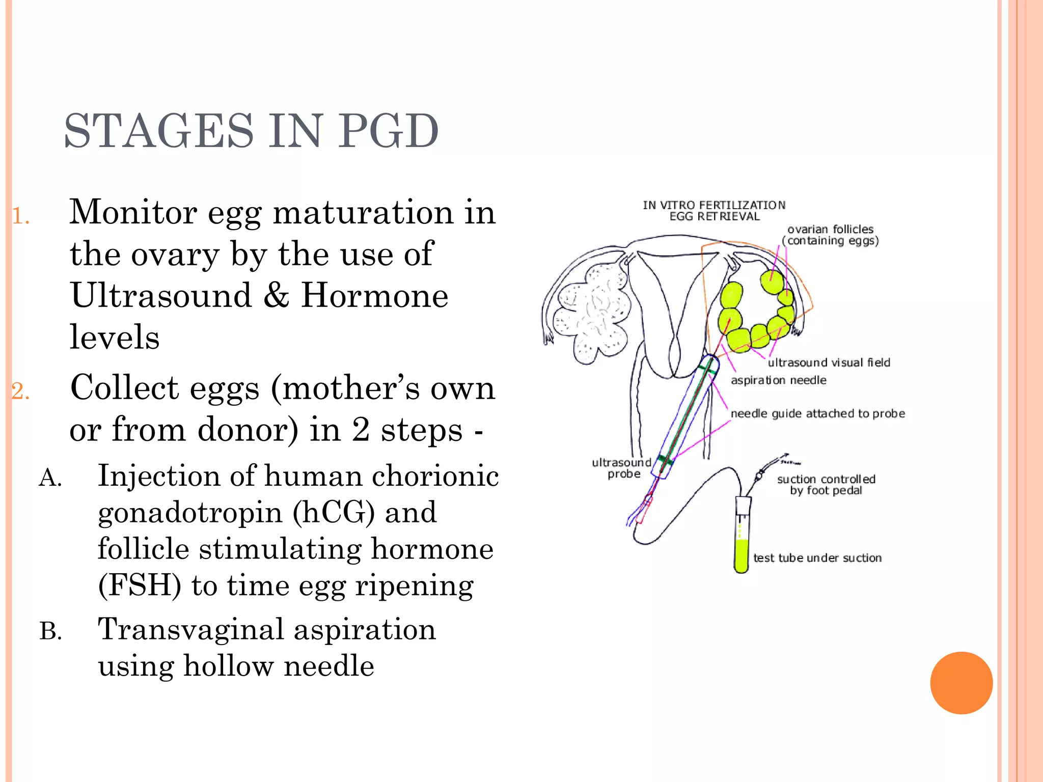 Pre implantation genetic diagnosis (pgd) | PPT