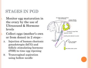 Pre implantation genetic diagnosis (pgd) | PPT