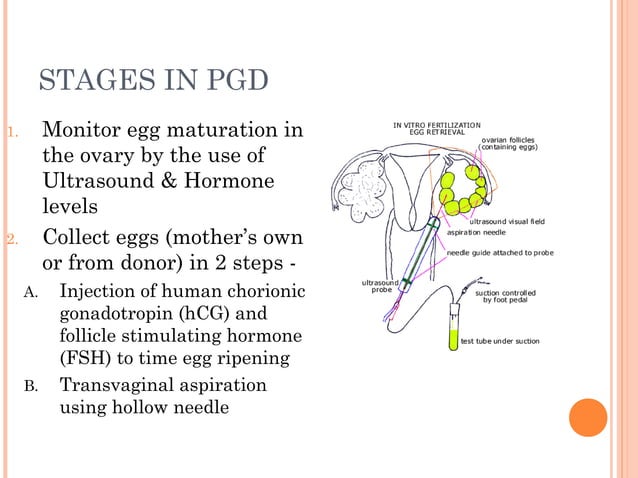 Pre implantation genetic diagnosis (pgd) | PPT