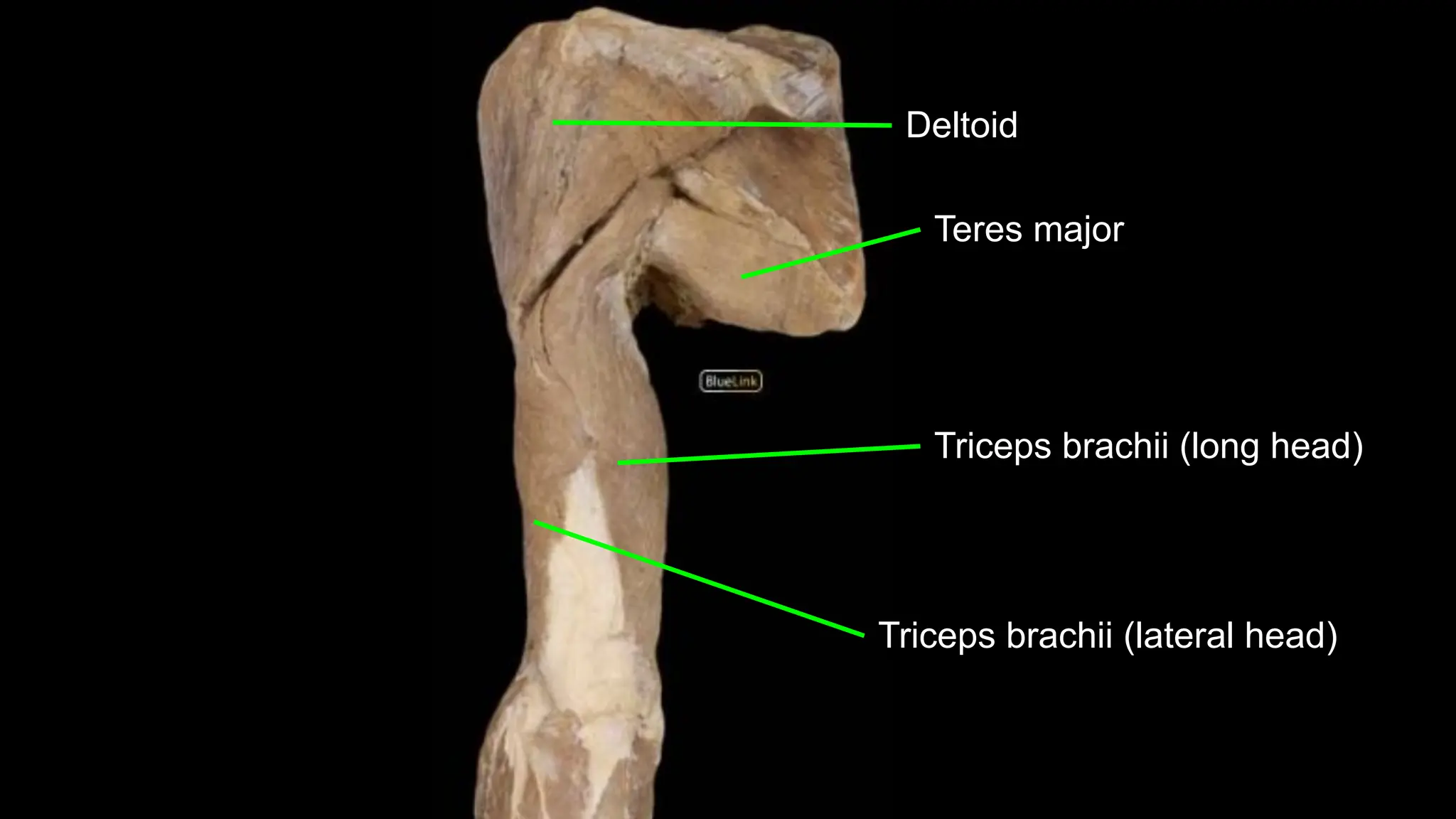 Skeletal Muscles on cadaver image and diagrams.pdf