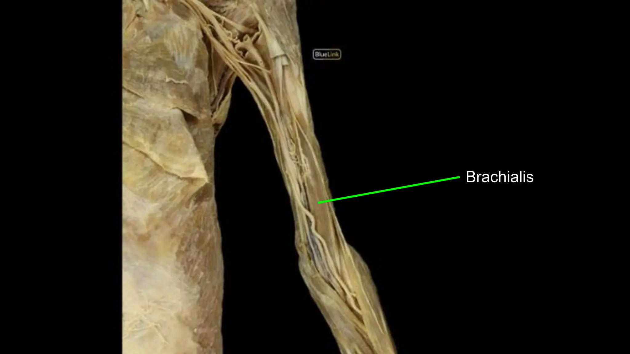 Skeletal Muscles on cadaver image and diagrams.pdf