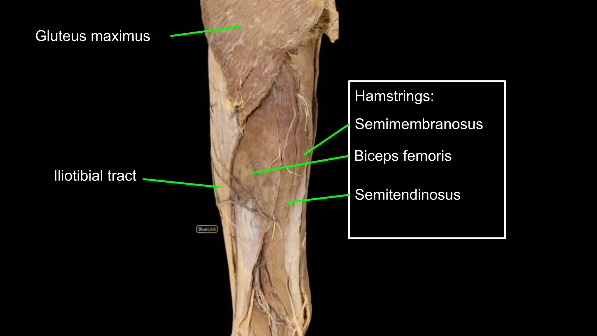 Skeletal Muscles on cadaver image and diagrams.pdf