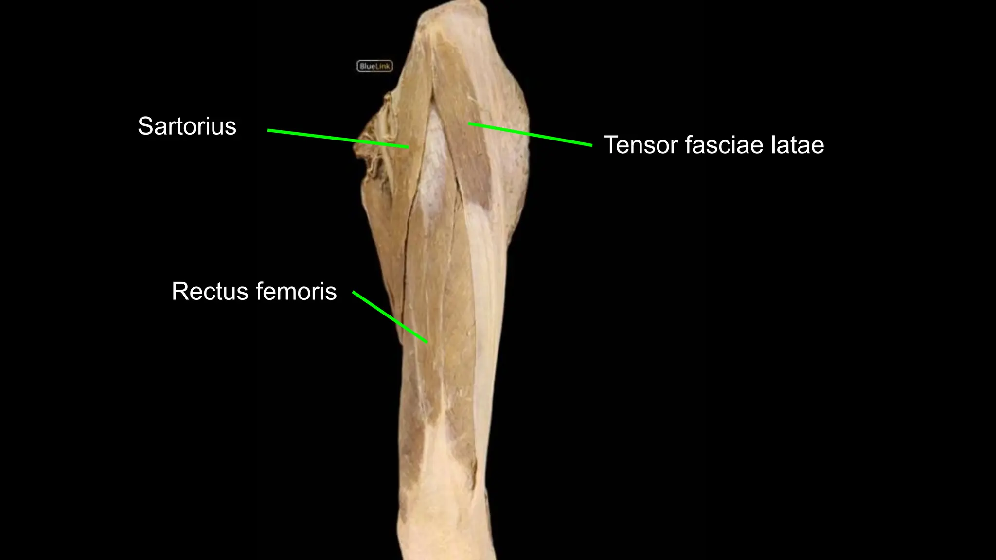Skeletal Muscles on cadaver image and diagrams.pdf