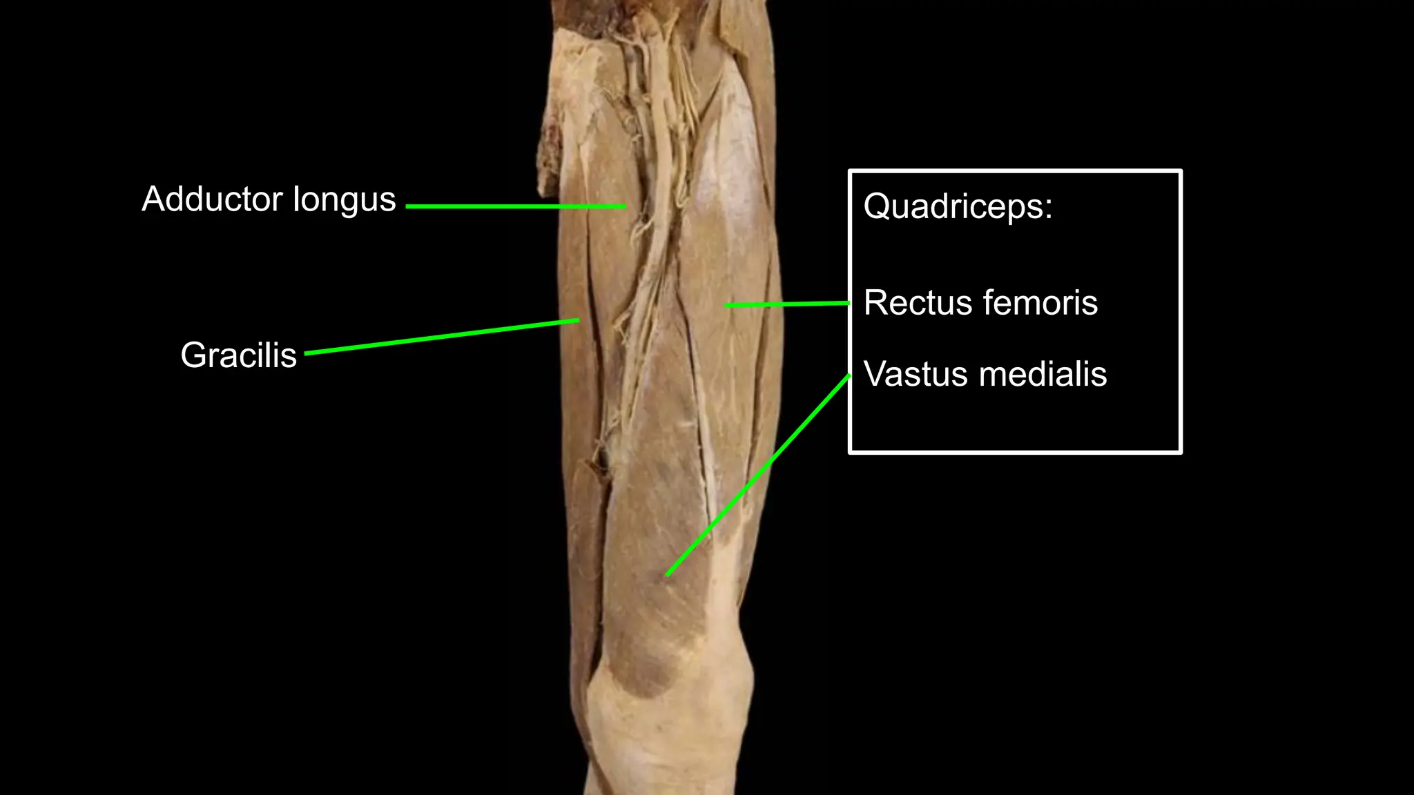 Skeletal Muscles on cadaver image and diagrams.pdf