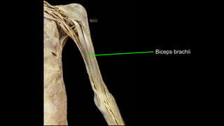 Skeletal Muscles on cadaver image and diagrams.pdf