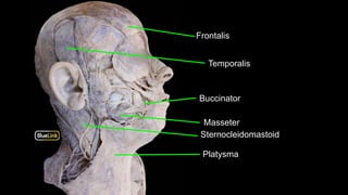 Skeletal Muscles on cadaver image and diagrams.pdf