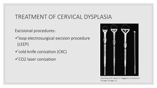 Pre malignant lesions of the cervix | PPTX