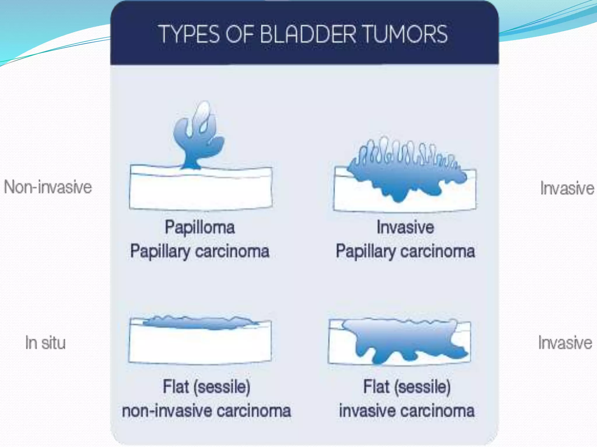 Pre management of carcinoma urinary bladder | PPT