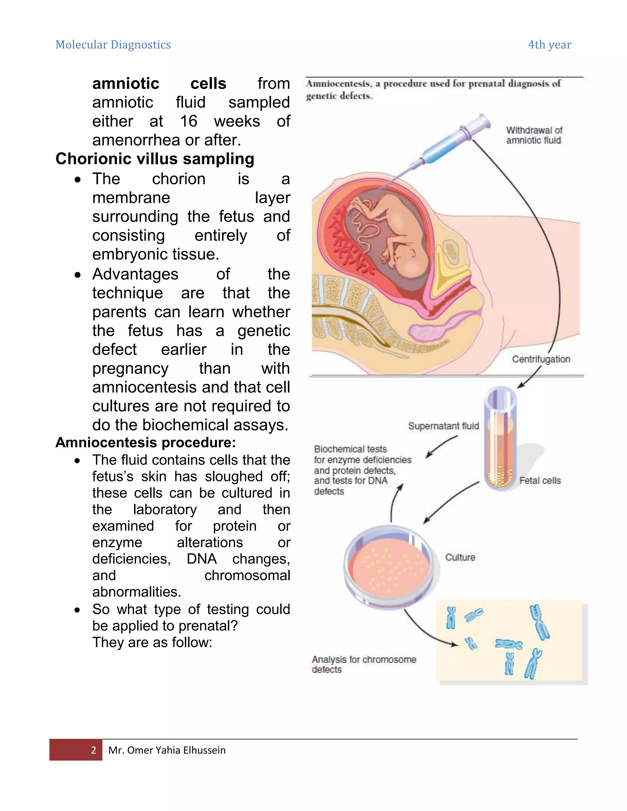 Pre natal test | PDF