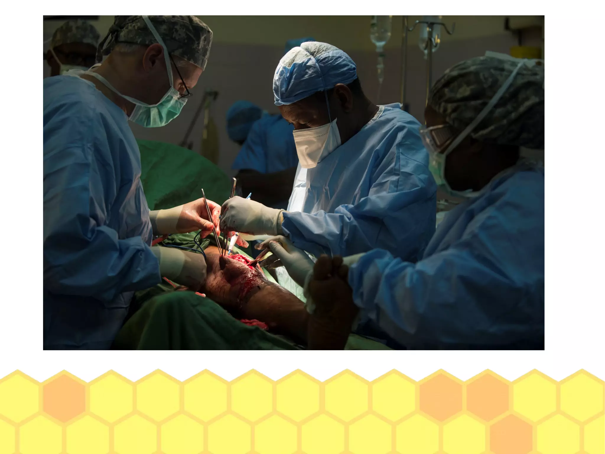 Pre operative assessment | PDF