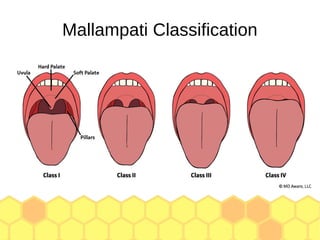 Pre operative assessment | PDF